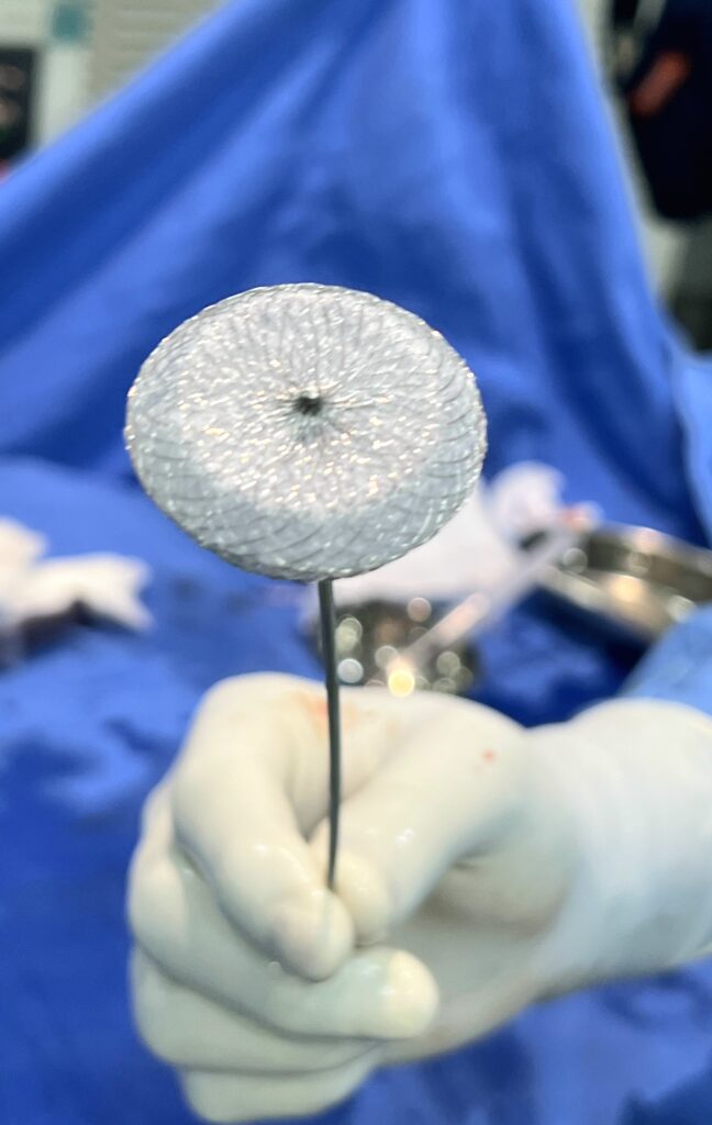 ASD VSD PDA Heart Defects: Complete Treatment Guide 2025